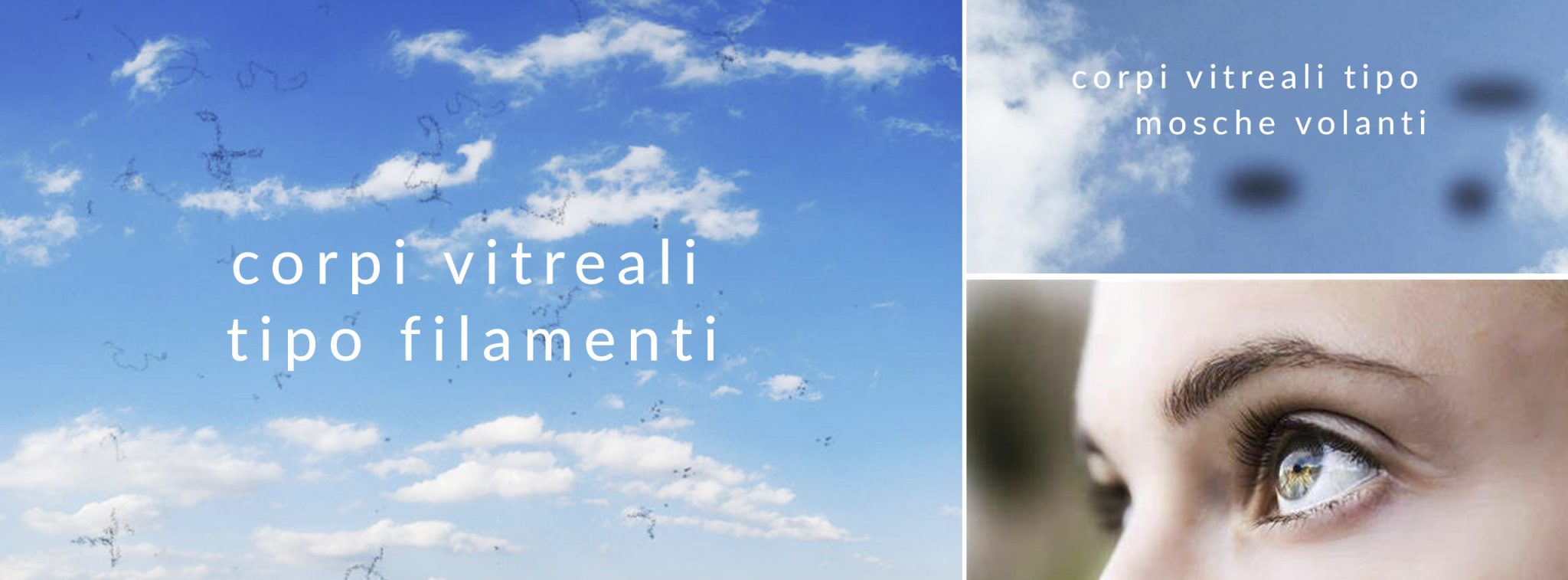 Mosche volanti e/o filamenti negli occhi? Parliamo di MIODESOPSIE.